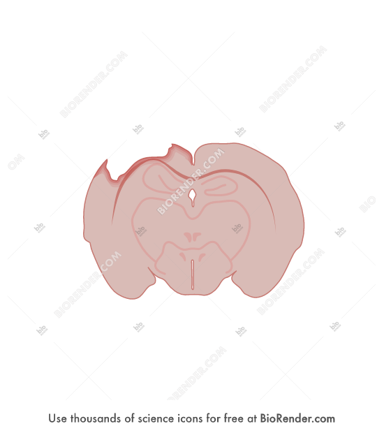Free Mouse brain (coronal, TBI) Icons, Symbols & Images | BioRender