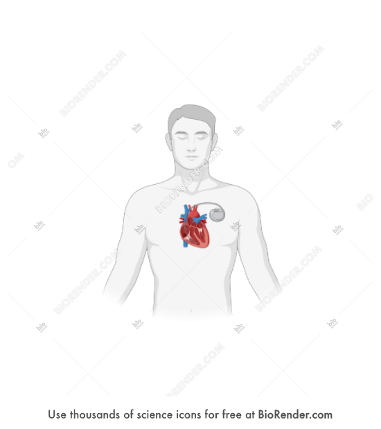 Free Heart (pacemaker, male) Icons, Symbols & Images | BioRender