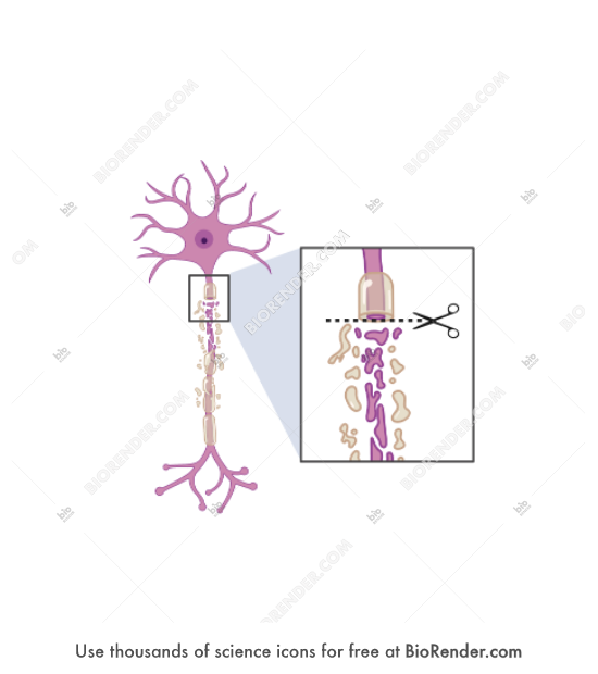 Free Multipolar neuron (axotomy with callout) Icons, Symbols & Images ...