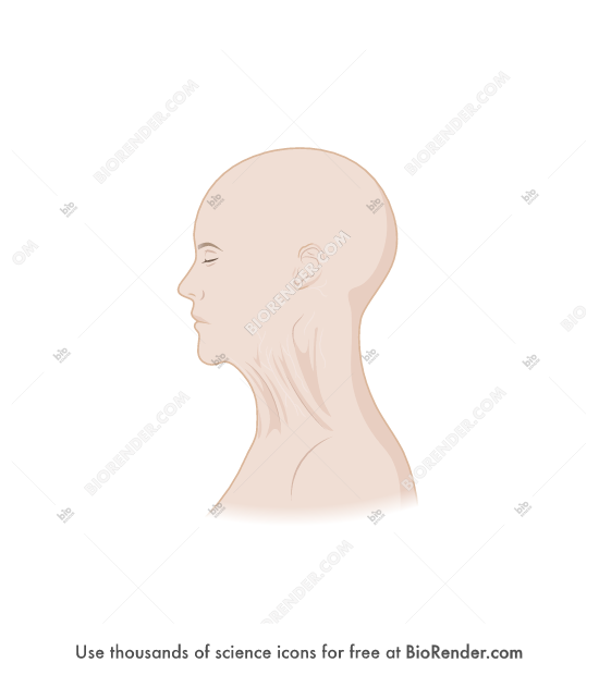 Free Burn wounds on adult female head (lateral) Icons, Symbols & Images ...