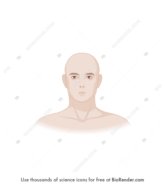 Free Burn wounds on adult male head (anterior) Icons, Symbols & Images ...