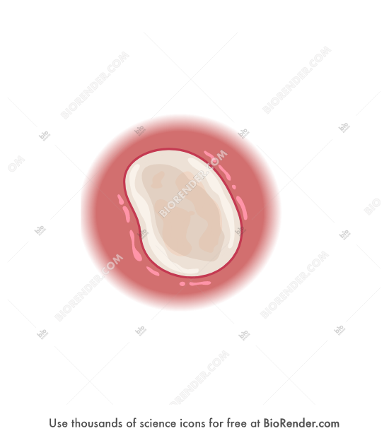Free Ulcer (shape 1) Icons, Symbols & Images | BioRender
