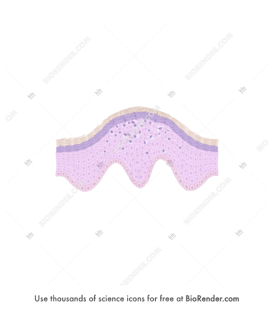 Free Epidermis (with HPV) Icons, Symbols & Images | BioRender