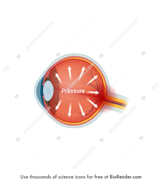 Free Eye (sagittal, glaucoma) Icons, Symbols & Images | BioRender