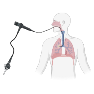 Alveoli with pneumonia | Editable Science Icons from BioRender
