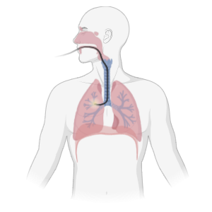 Bronchoscopy | Editable Science Icons from BioRender