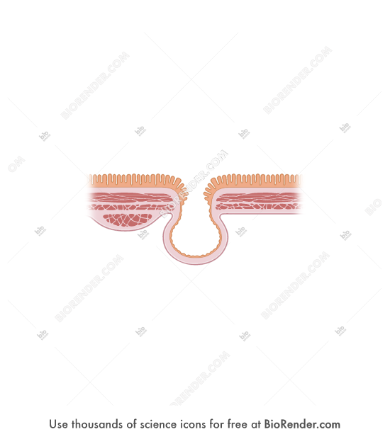 Free Colon walls (longitudinal cross-section, diverticula) Icons ...