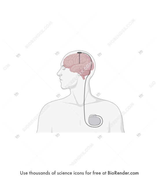 Free Deep brain stimulation Icons, Symbols & Images | BioRender