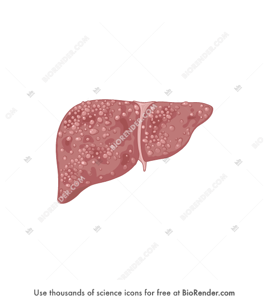 Free Liver (fibrotic) Icons, Symbols & Images | BioRender