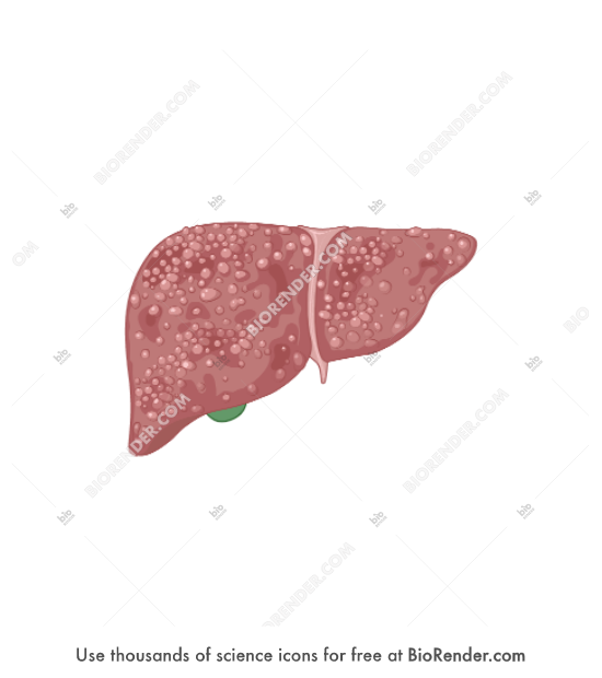 Free Liver (fibrotic, with gallbladder) Icons, Symbols & Images | BioRender