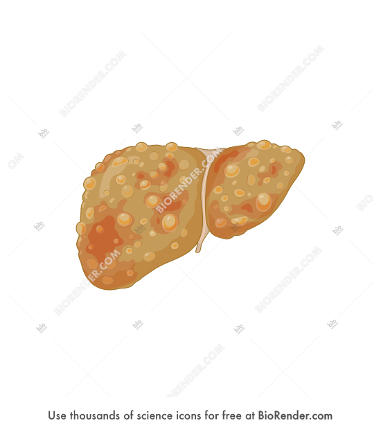 Free Liver (fatty 2) Icons, Symbols & Images | BioRender