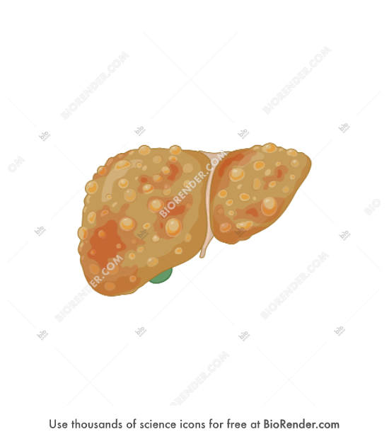Free Liver (fatty 2, with gallbladder) Icons, Symbols & Images | BioRender