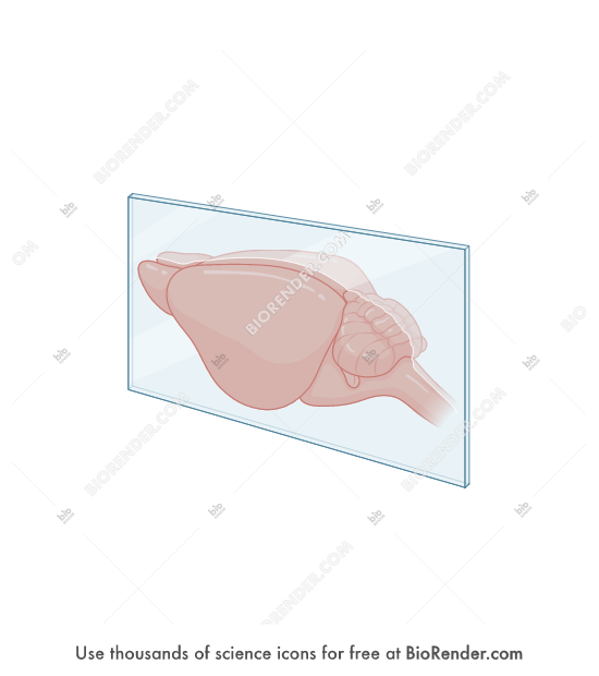 Free Mouse brain (dorsal view, caudal-rostral turn, sagittal cut ...