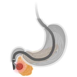 Free Stool (lienteric diarrhea) Icons, Symbols & Images | BioRender