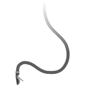 Free Endoscopic ultrasound guided fine needle aspiration (EUS-FNA ...