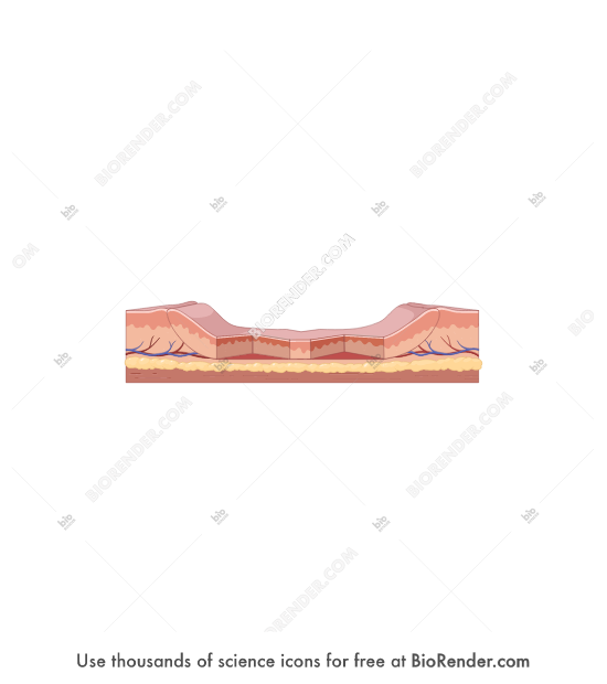 Free Skin mesh (lateral) Icons, Symbols & Images | BioRender