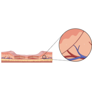 Free Tumor (round, necrosis 2) Icons, Symbols & Images | BioRender