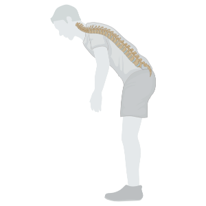 Limb (amputation stump) | Editable Science Icons from BioRender