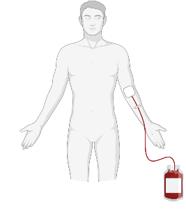 Limb (amputation stump) | Editable Science Icons from BioRender
