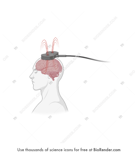 Free Transcranial magnetic stimulation coil (on lateral male head ...