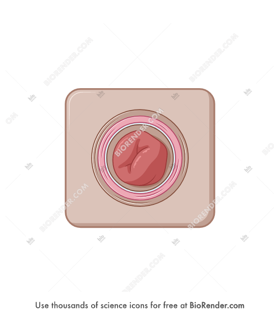 Free Ostomy system (patch) Icons, Symbols & Images | BioRender