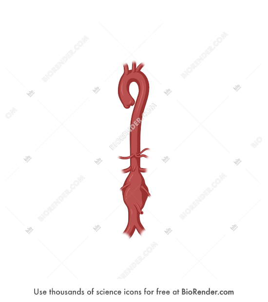 Free Aorta (with abdominal aneurysm) Icons, Symbols & Images | BioRender