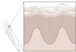 Free Tumor (round, necrosis 2) Icons, Symbols & Images | BioRender