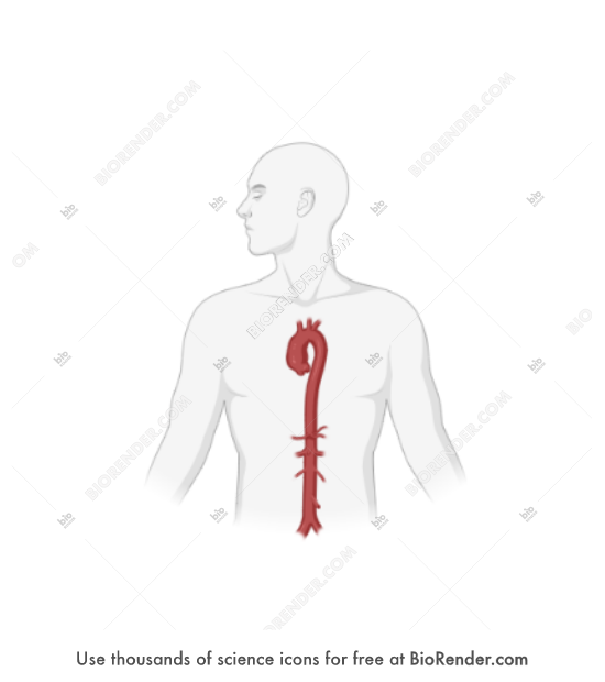 Free Adult (with aneurysm of ascending aorta) Icons, Symbols & Images ...