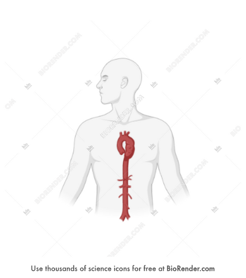 Free Adult (with aneurysm of descending thoracic aorta) Icons, Symbols ...