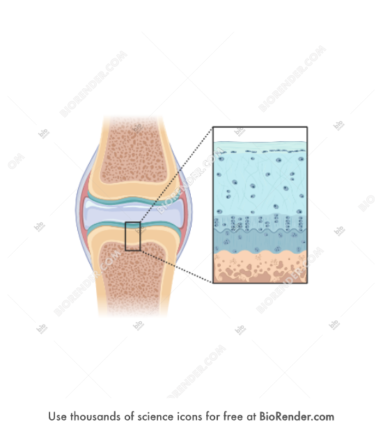 Free Joint (with osteochondral interface callout) Icons, Symbols ...