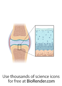 Free Joint (with osteochondral interface callout) Icons, Symbols ...