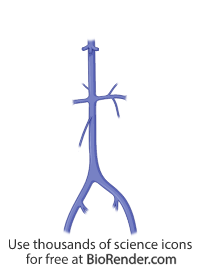 Free Heart (myocardial infarction) Icons, Symbols & Images | BioRender