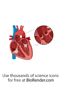 Free Heart (myocardial infarction) Icons, Symbols & Images | BioRender