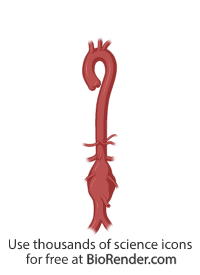 Free Aorta (with abdominal aneurysm) Icons, Symbols & Images | BioRender