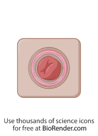 Free Ostomy system (patch) Icons, Symbols & Images | BioRender