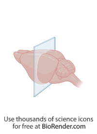 Free Mouse brain (dorsal view, caudal-rostral turn, coronal cut) Icons ...