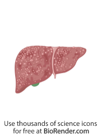 Free Liver (fibrotic, with gallbladder) Icons, Symbols & Images | BioRender