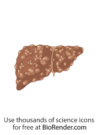 Free Liver (cirrhosis) Icons, Symbols & Images | BioRender