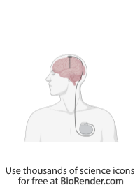 Free Deep brain stimulation Icons, Symbols & Images | BioRender