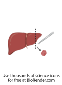 Free Liver (resection) Icons, Symbols & Images | BioRender