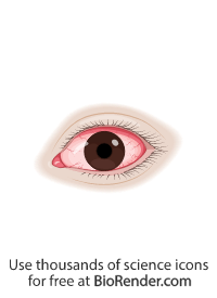 Free Eye frontal (conjunctivitis) Icons, Symbols & Images | BioRender