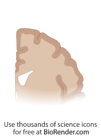 Free Brain (coronal cut, simplified, left top hemisphere) Icons ...