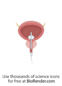 Free Bladder (with prosthetic urethra) Icons, Symbols & Images | BioRender