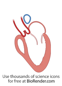 Free Heart (echocardiogram, PLAX) Icons, Symbols & Images | BioRender