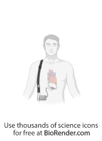 Free Left ventricular assist device (on man) Icons, Symbols & Images ...