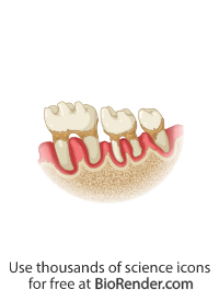 Free Mouse teeth (molars, gums, peridontitis) Icons, Symbols & Images ...