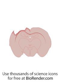 Free Mouse brain (coronal, TBI) Icons, Symbols & Images | BioRender