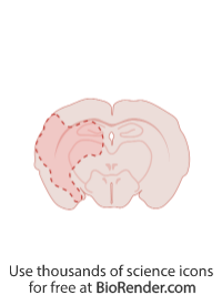 Free Mouse coronal brain (with stroke) Icons, Symbols & Images | BioRender