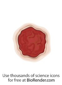 Free Wound (chronic) Icons, Symbols & Images | BioRender