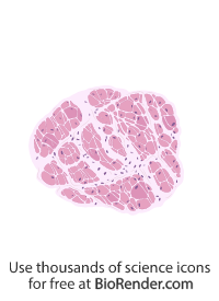 Free Muscle cross-section (fibrotic) Icons, Symbols & Images | BioRender